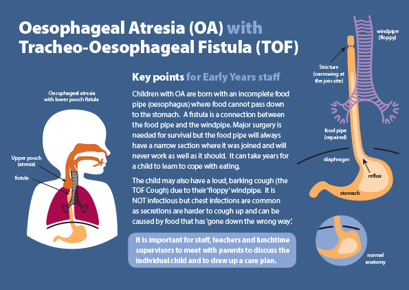 TOFS | Leaflets & Publications